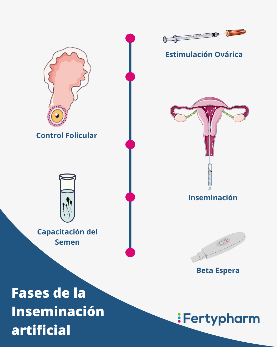 Inseminación Artificial: qué es y cómo se hace - Fertypharm